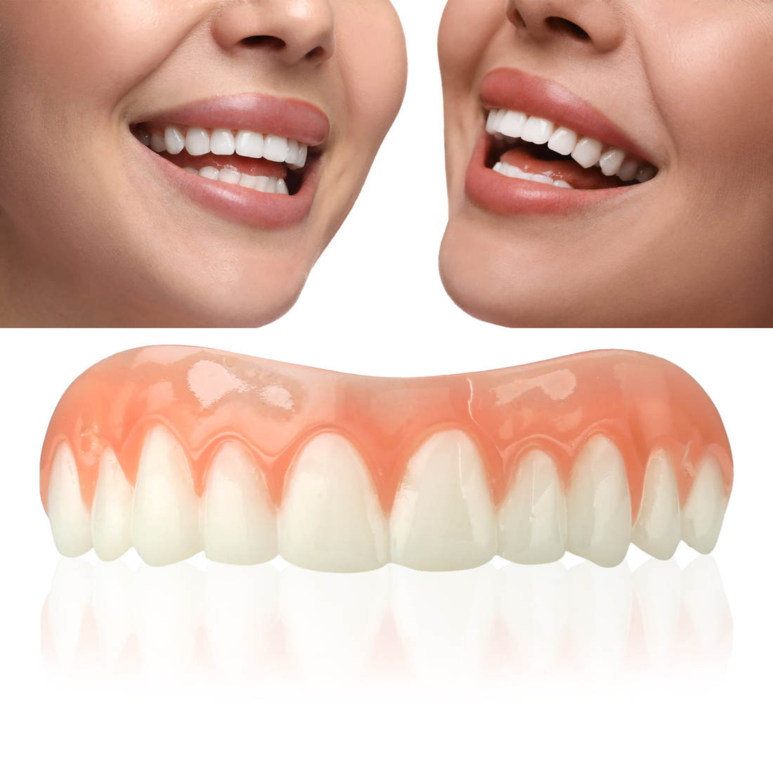 American Smile Veneers - Instant Smile Veneer for a Perfect Smile ...
